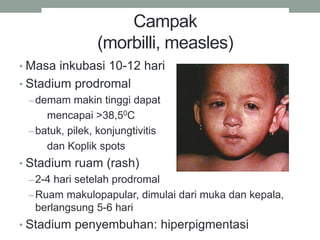 CAMPAK RUBELLA.pptx