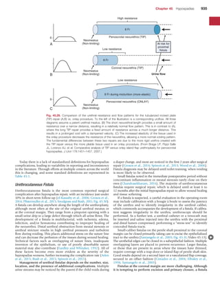 Campbell hypospadia | PDF