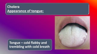 Camphora homeopathic materia medica slide show presentation by Dr ...