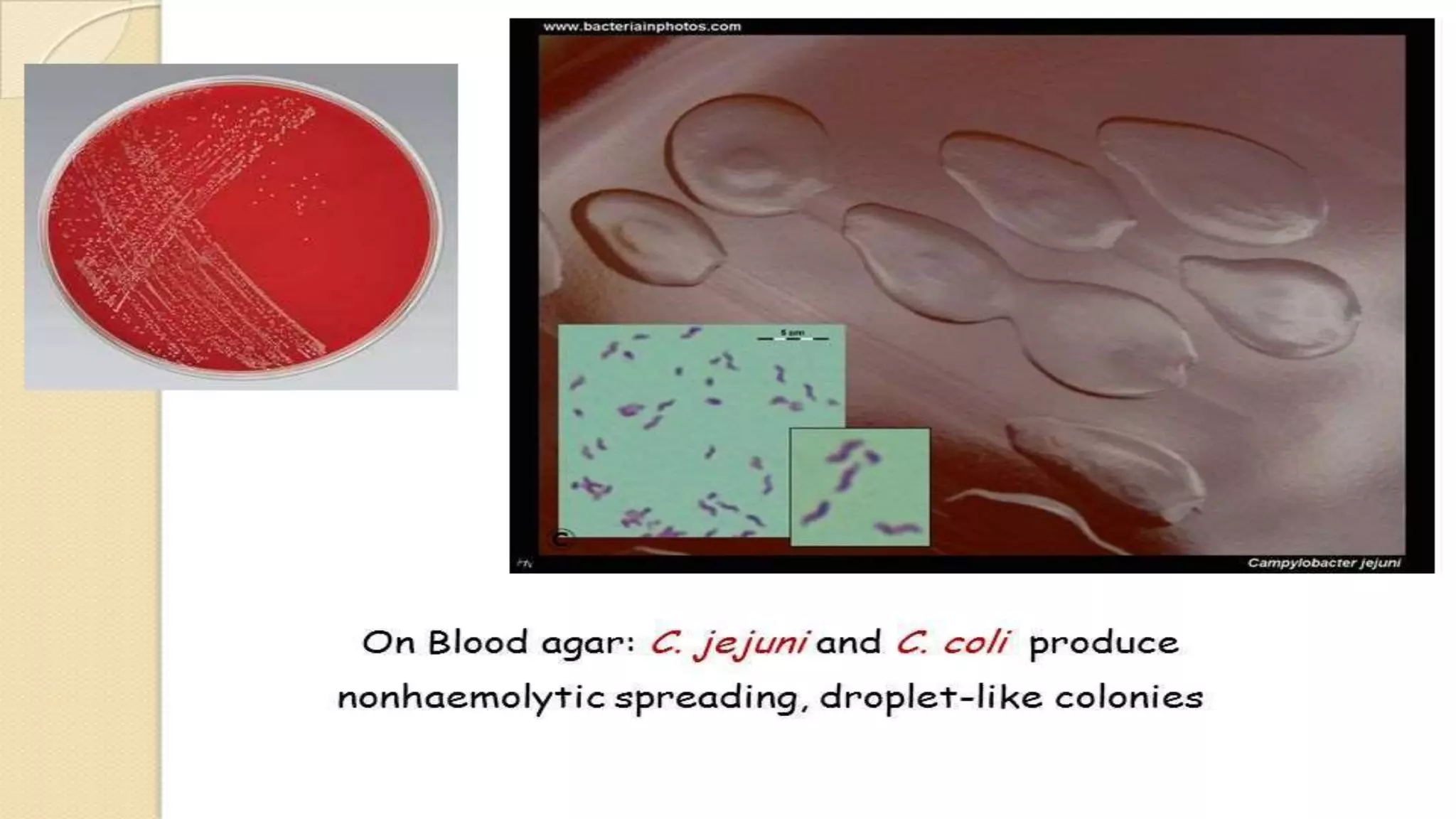 Campylobacter | PPTX
