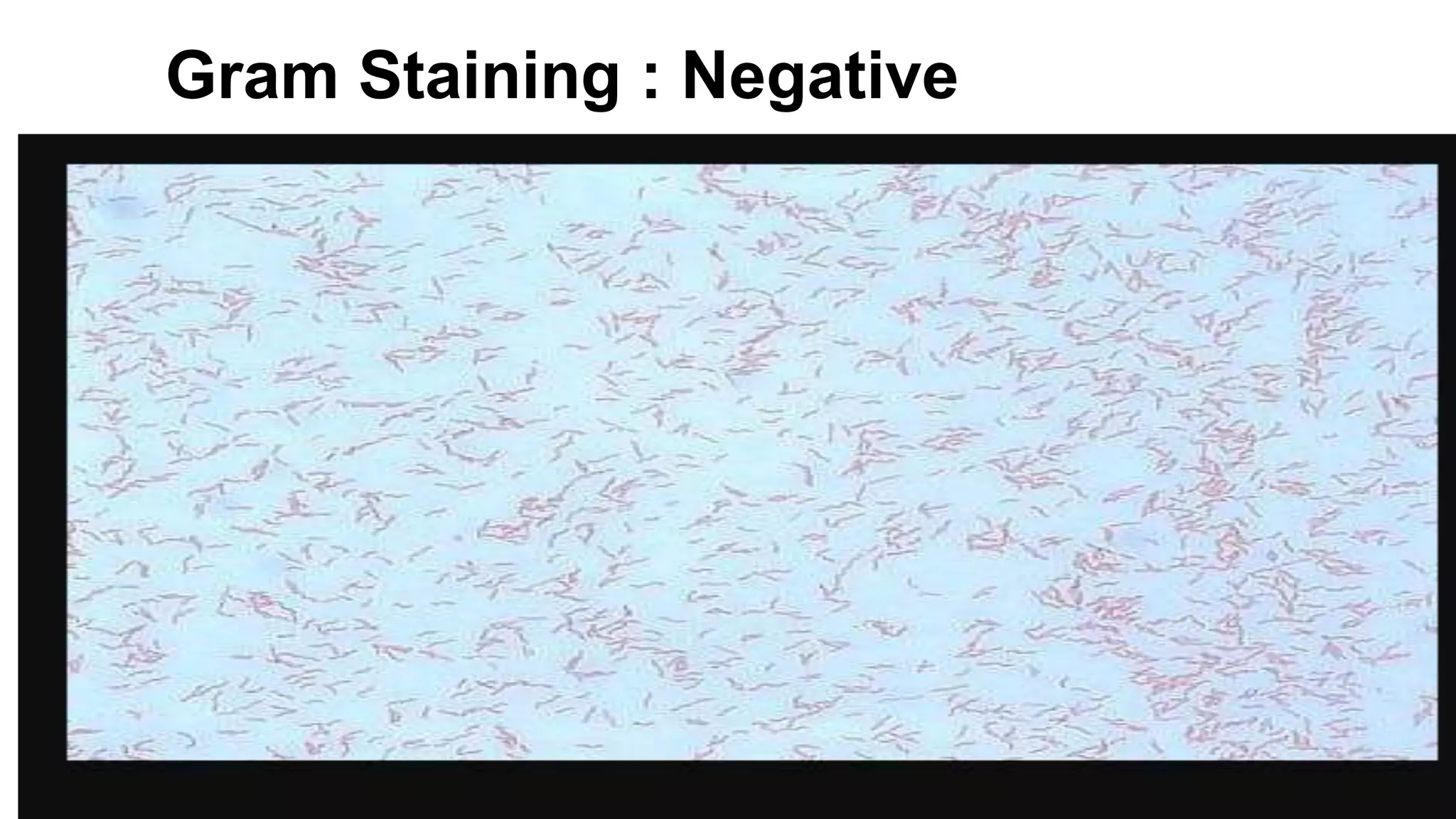 Campylobacter | PPTX