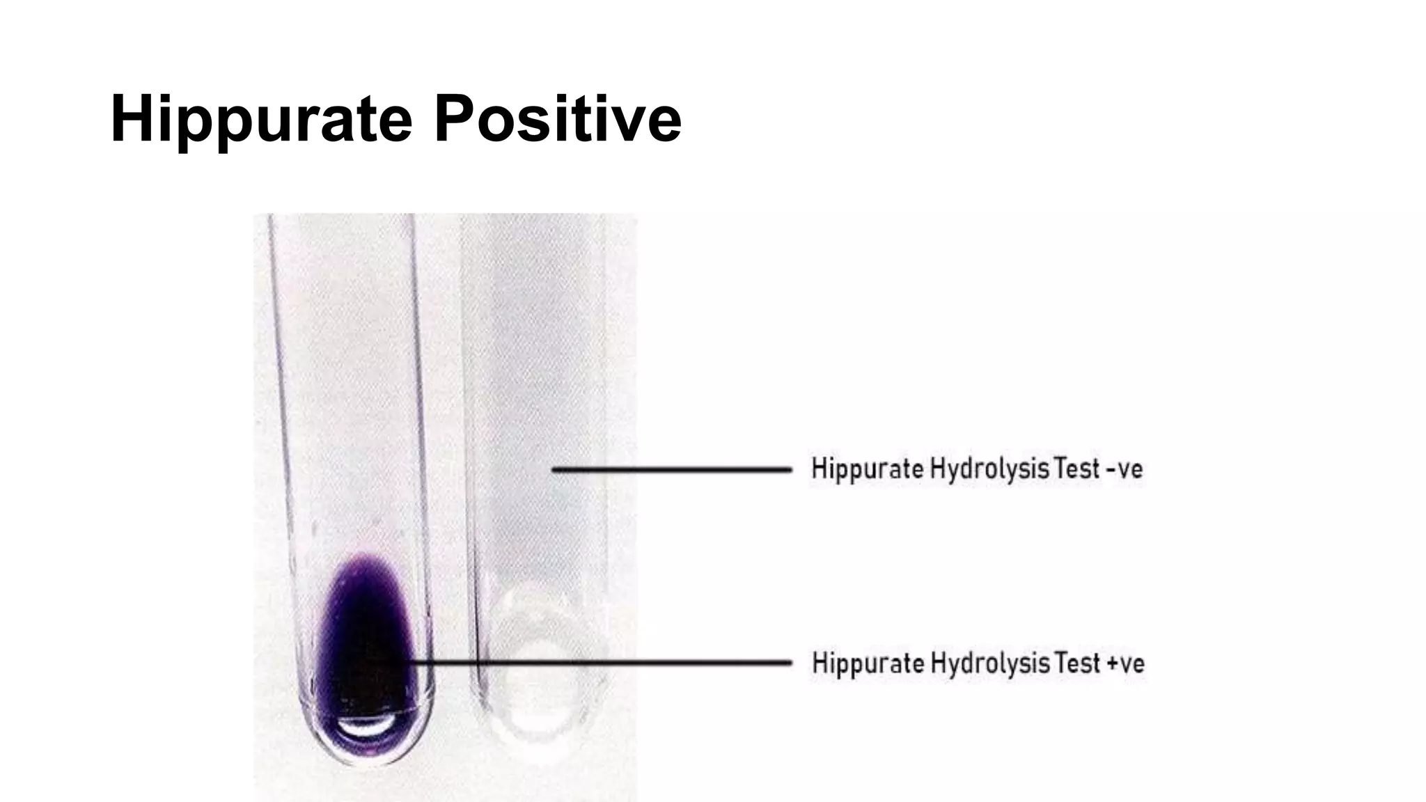 Campylobacter | PPTX