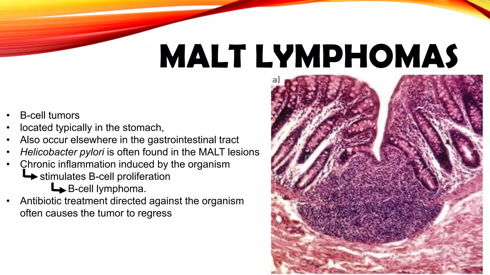 CAMPYLOBACTER & HELICOBACTER (Curved Gram-Negative Rods affecting the ...