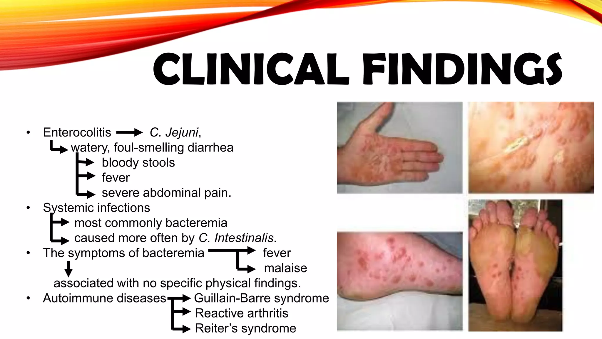 CAMPYLOBACTER & HELICOBACTER (Curved Gram-Negative Rods affecting the ...
