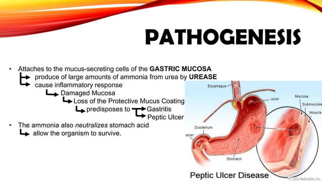 CAMPYLOBACTER & HELICOBACTER (Curved Gram-Negative Rods affecting the ...