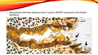 CAMPYLOBACTER & HELICOBACTER (Curved Gram-Negative Rods affecting the ...