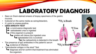 CAMPYLOBACTER & HELICOBACTER (Curved Gram-Negative Rods affecting the ...