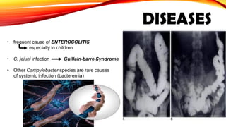CAMPYLOBACTER & HELICOBACTER (Curved Gram-Negative Rods affecting the ...