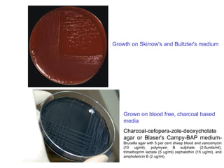 Bacteriology bacteria. .Campylobacter.ppt