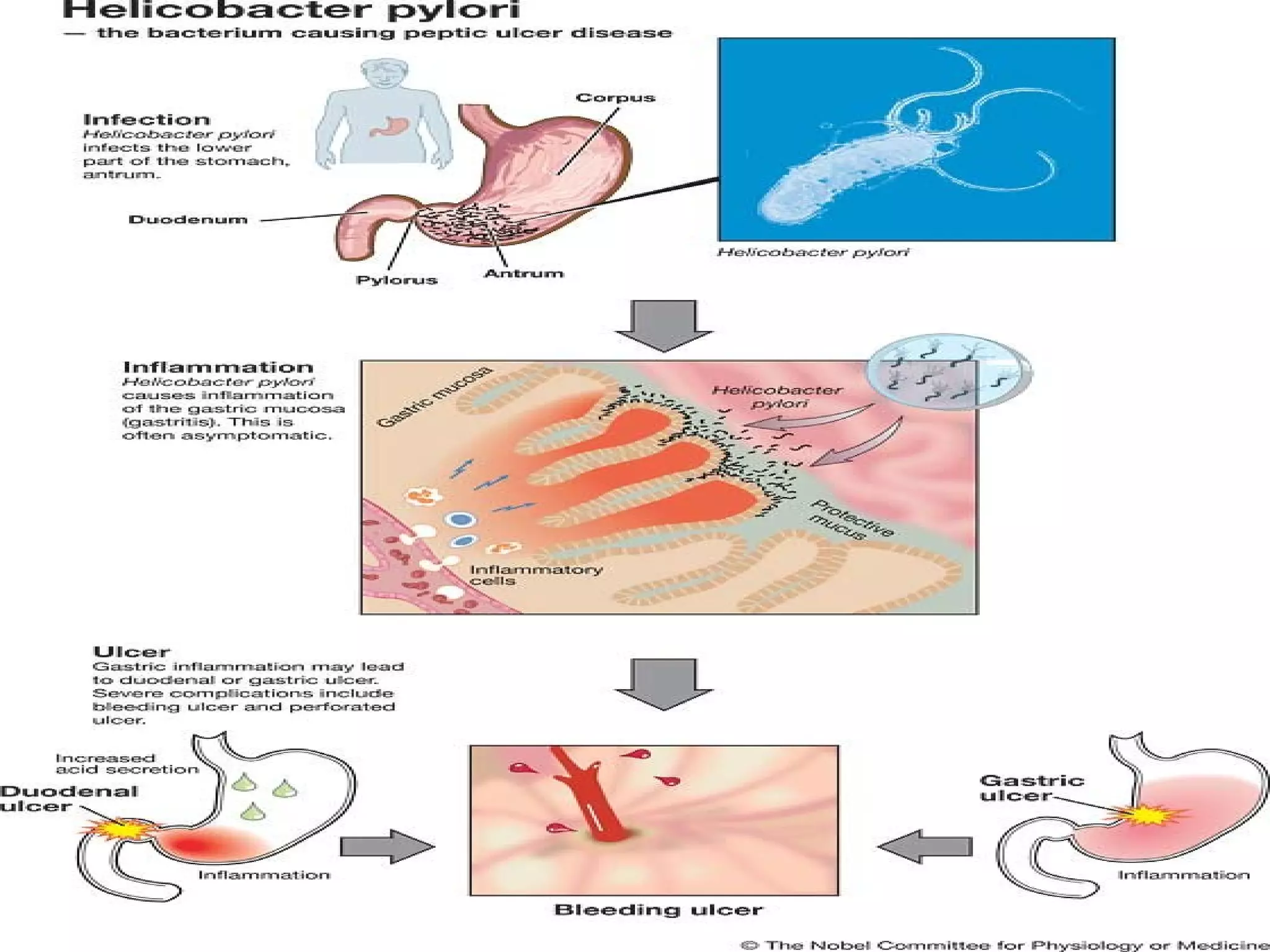 Campylobacter & Helicobacter | PPT