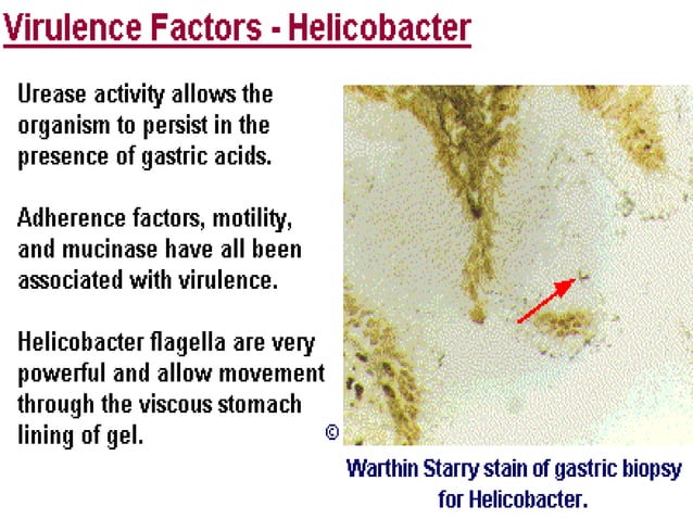 Campylobacter & Helicobacter | PPT