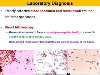 Campylobacter & Helicobacter.ppt