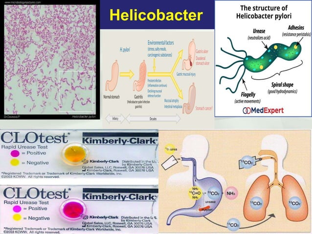 Campylobacter & Helicobacter.ppt