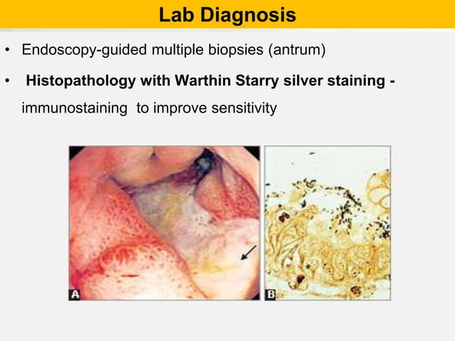 Campylobacter & Helicobacter.ppt