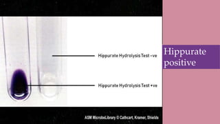 Campylobacter jejuni | PPTX