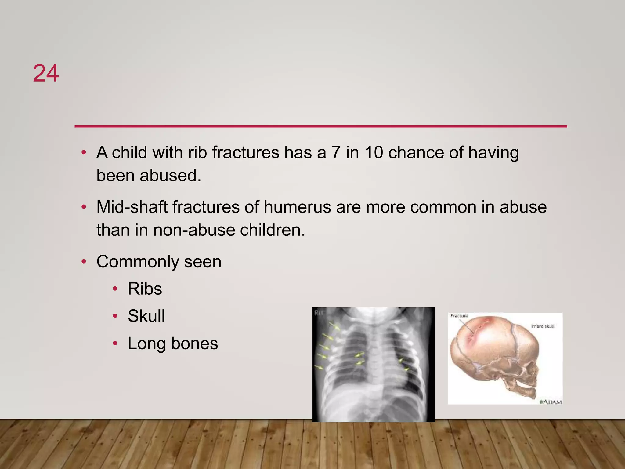 child abuse and neglect | PPTX