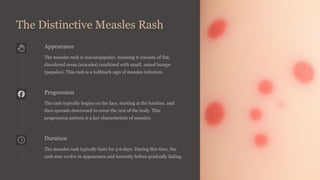 Can You Explain the Effects and Severity of Measles? A Complete Guide | PPT