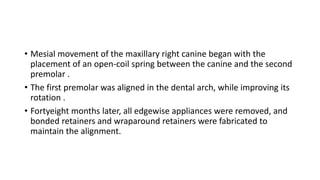 Canine transposition | PPT