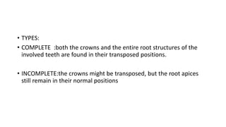 Canine transposition | PPT