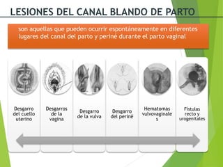 CANAL BLANDO- EPISIOTOMIA Y DESGARROS OBSTETRICOS | PPTX