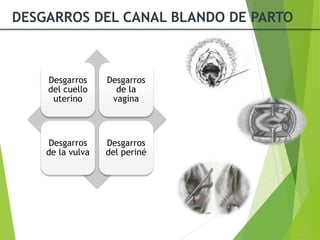 CANAL BLANDO- EPISIOTOMIA Y DESGARROS OBSTETRICOS | PPTX