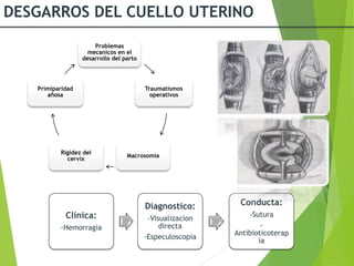 CANAL BLANDO- EPISIOTOMIA Y DESGARROS OBSTETRICOS | PPTX