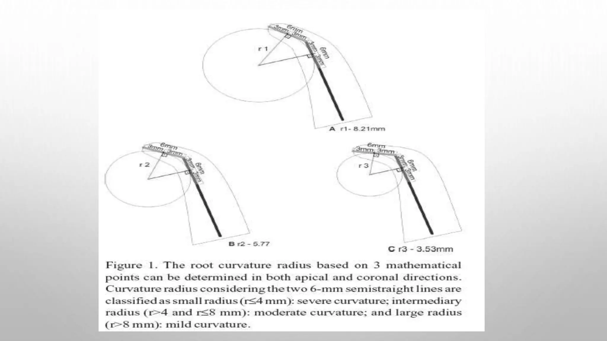 Canal curvatures and determination method final | PPTX