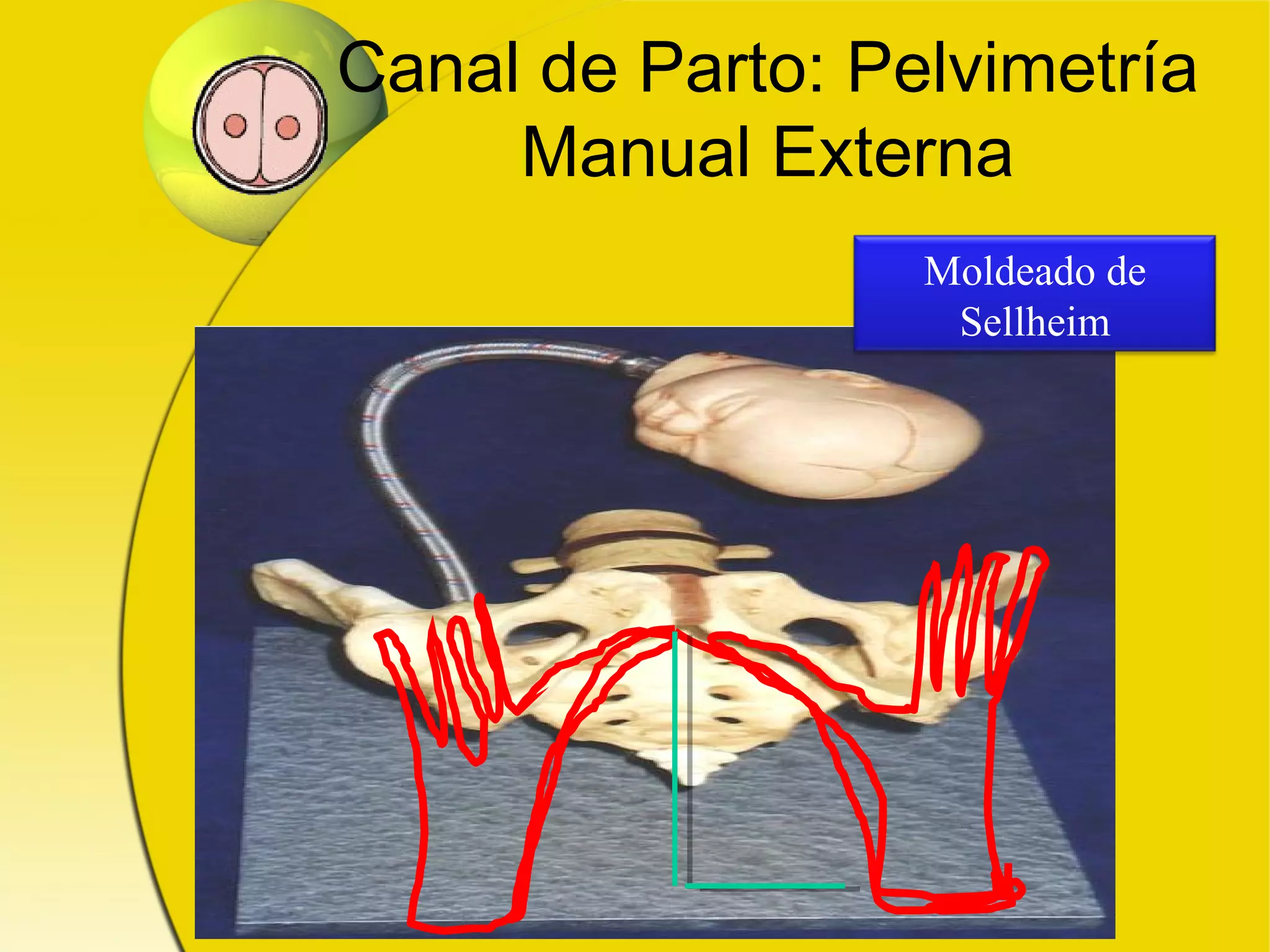 Canal De Parto Y Móvil Fetal Ppt