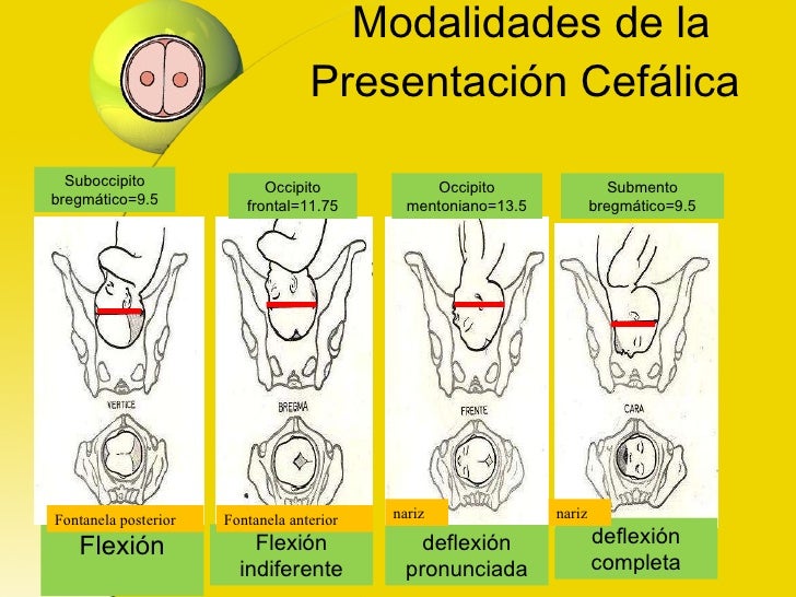 Canal De Parto Y Móvil Fetal