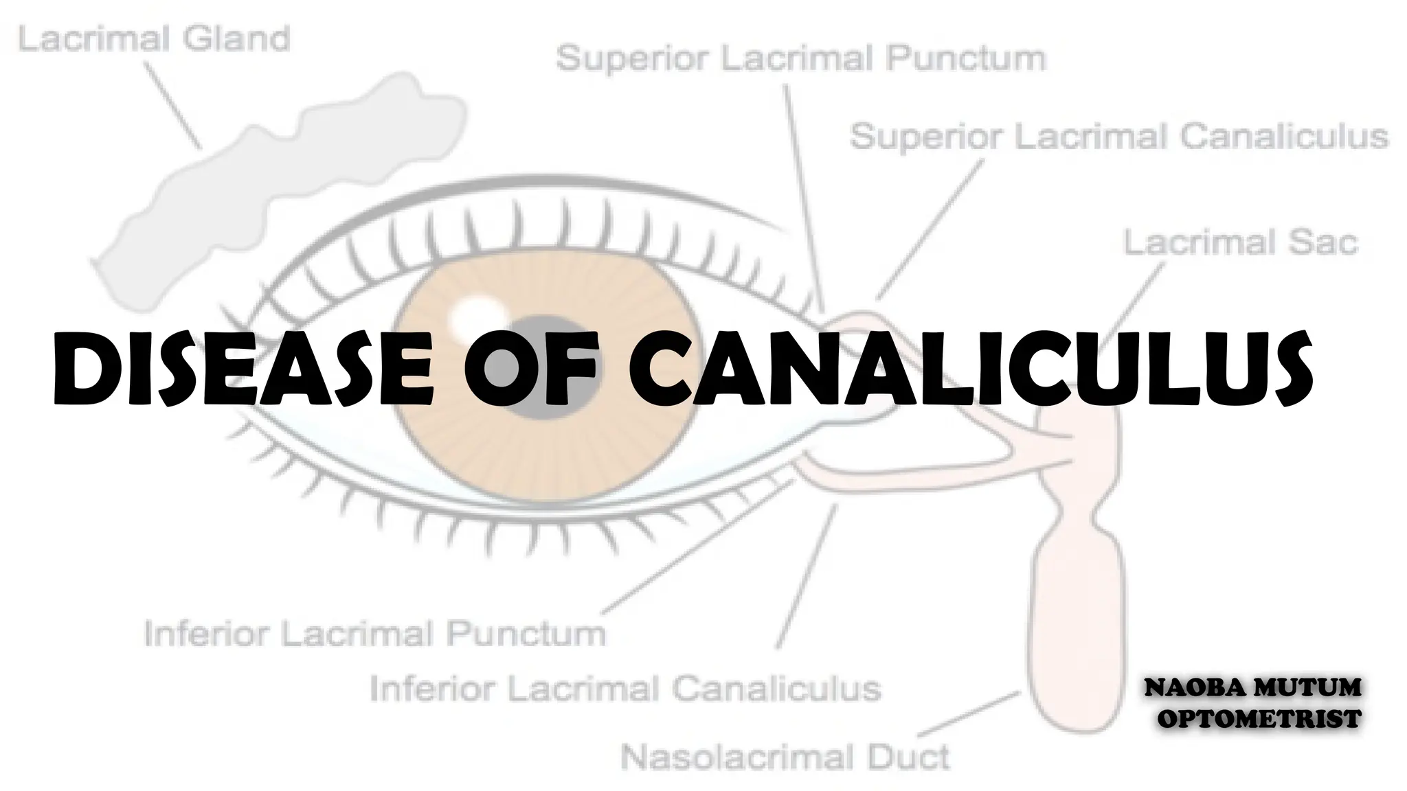 Disease of canaliculus presentation.ppt canaliculitis | PPTX