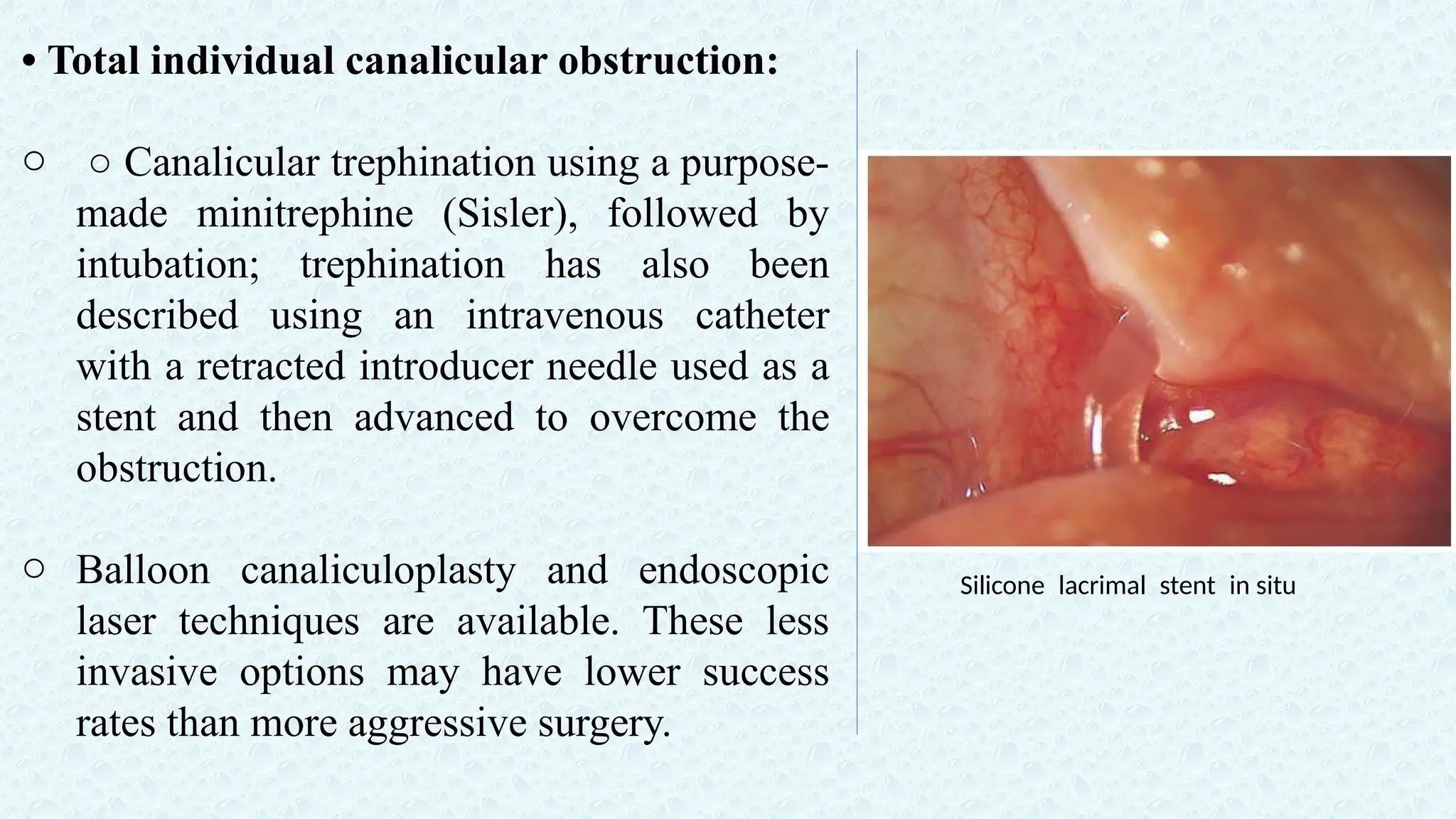 Disease of canaliculus presentation.ppt canaliculitis | PPTX