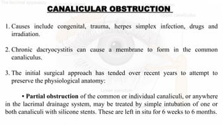Disease of canaliculus presentation.ppt canaliculitis | PPTX