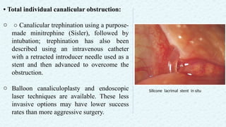 Disease of canaliculus presentation.ppt canaliculitis | PPTX