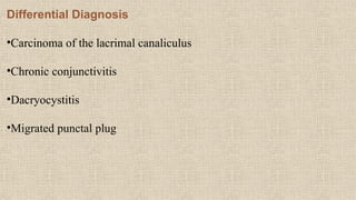 Disease of canaliculus presentation.ppt canaliculitis | PPTX