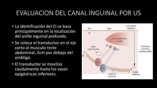 Canal inguinal | PPTX