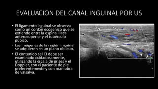 Canal inguinal | PPTX