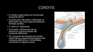 Canal inguinal | PPTX