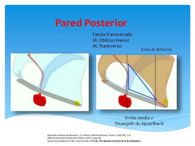 Canal inguinal y hernias