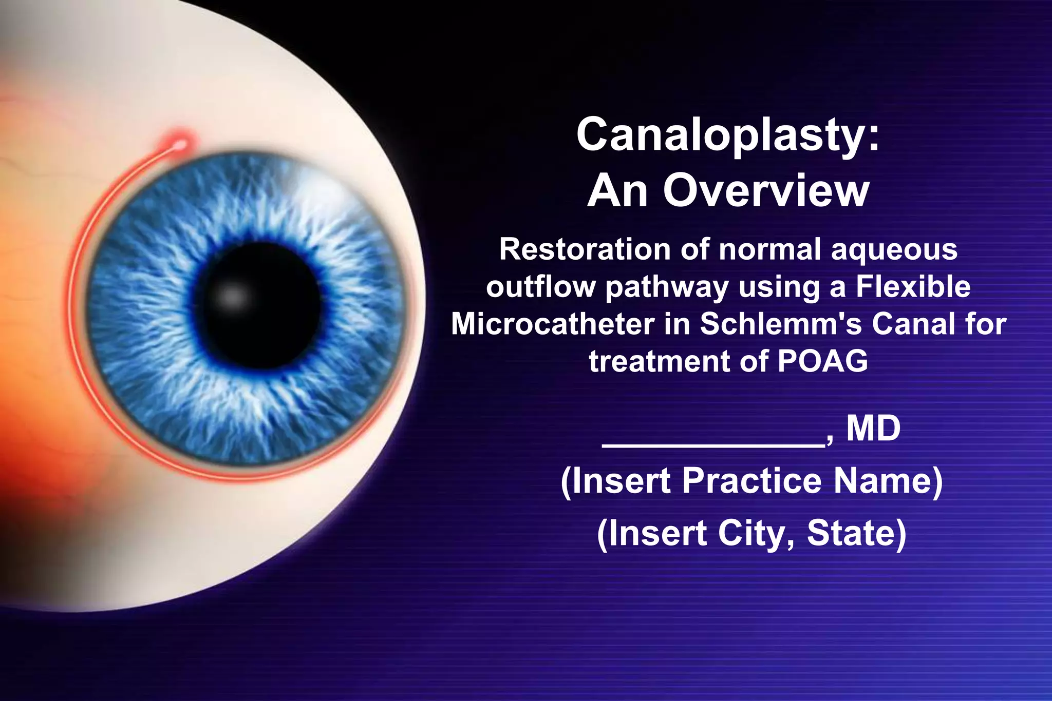 Canaloplasty Overview 3 Year Clinical Results Burchfield111510 | PPT