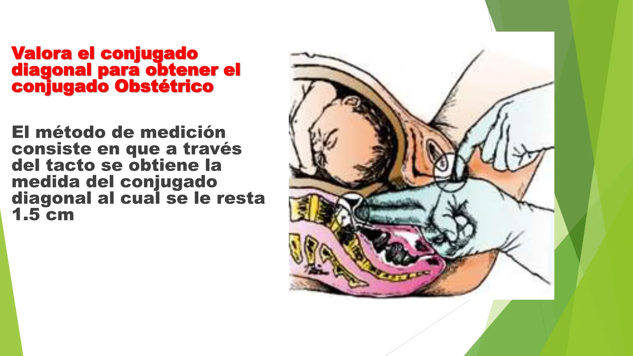 Canal Oseo Y Blando Del Parto Pelvimetriapptx Ppt