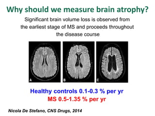Can brain atrophy measurement help us in monitoring MS progression in ...