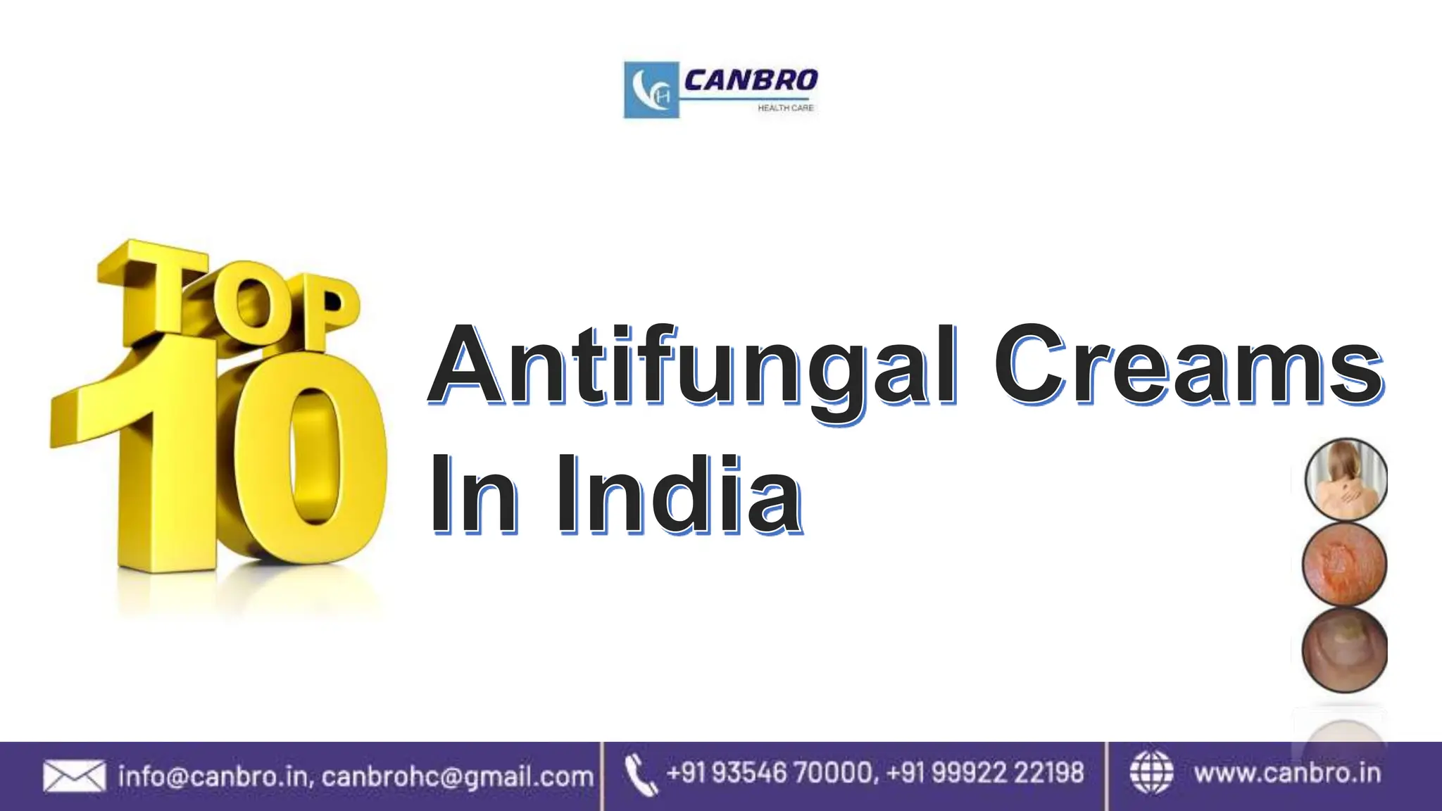 Top 10 Antifungal Creams In India | PPTX