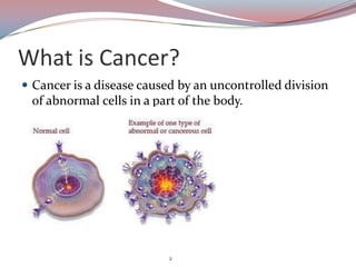Cancer | PPTX