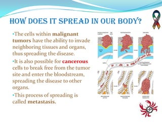 Cancer | PPTX