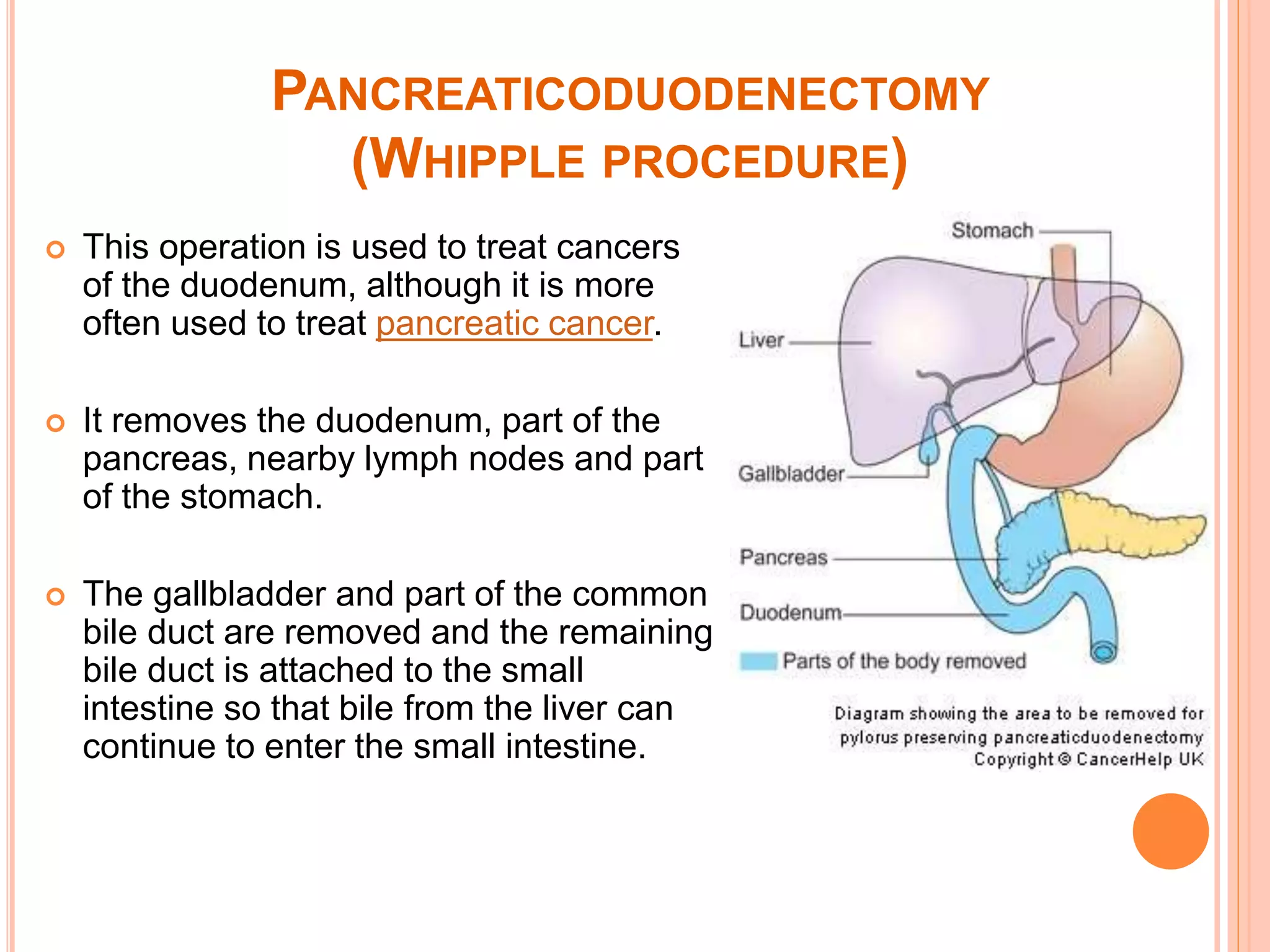 Cancer (Diet therapy, Nutritional care) | PPTX