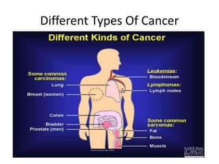 Cancer | PPTX