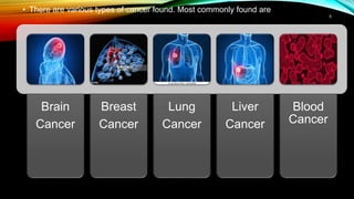 Cancer | PPTX