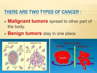 Cancer | PPT