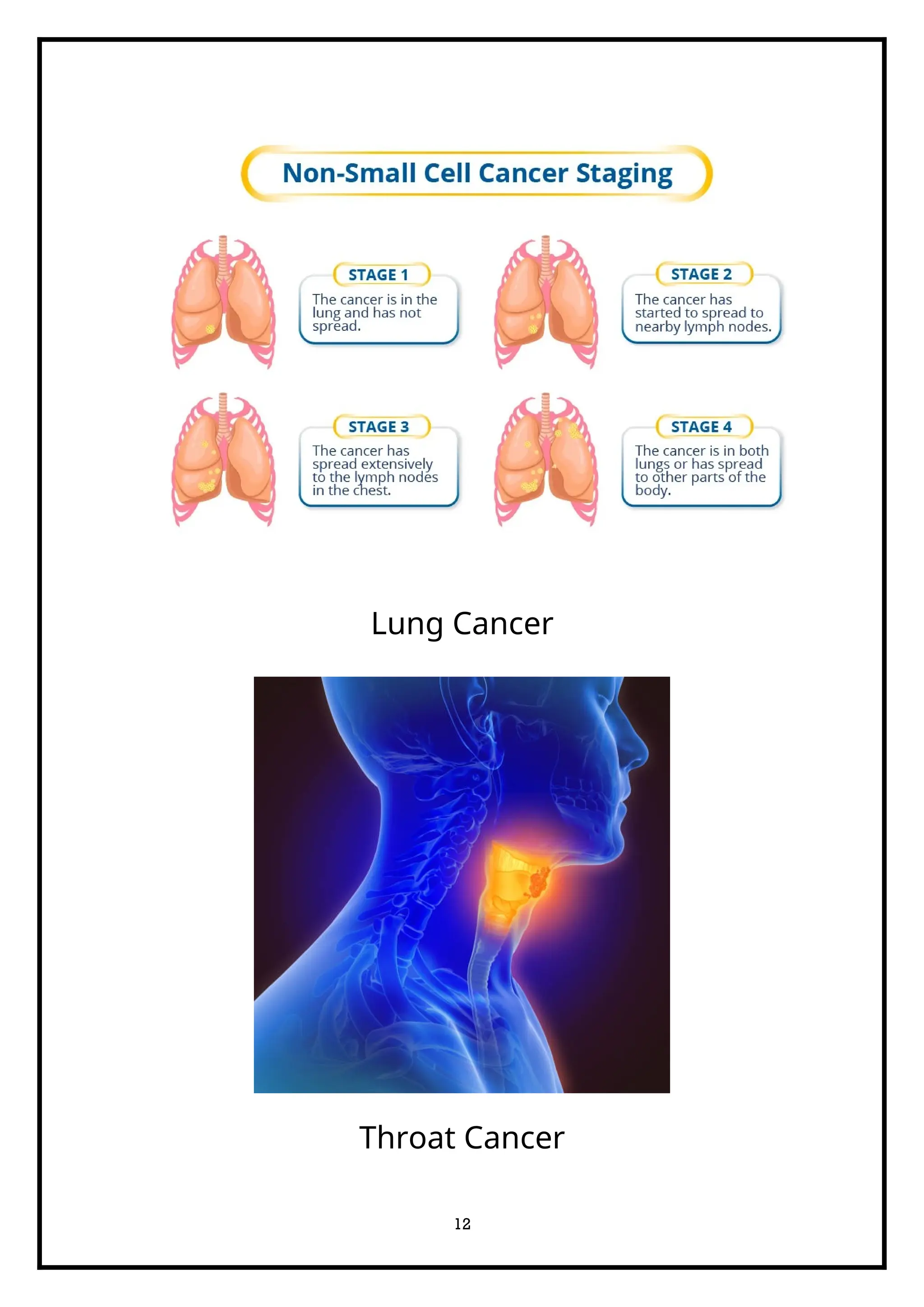 Class 12 biology project on the topic cancer | DOCX