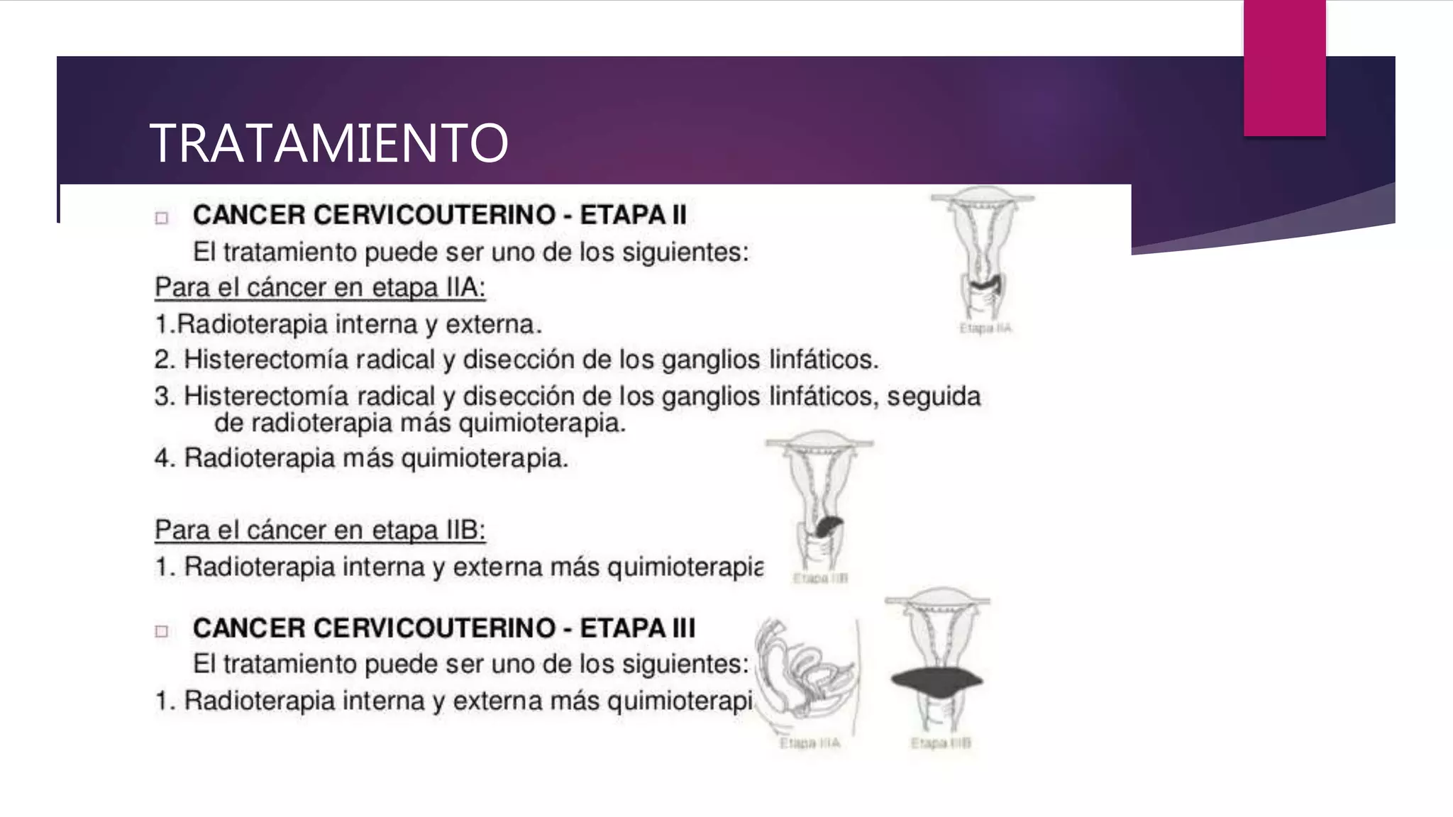 Cancer de-cervix | PPTX